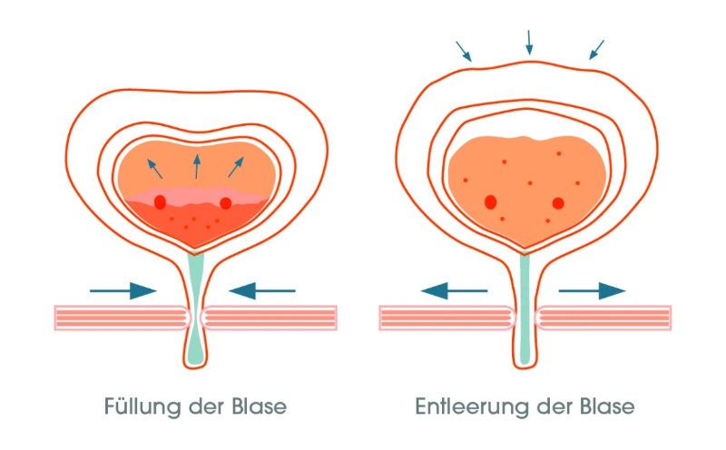 Kann Der Darm Auf Die Blase Drucken
