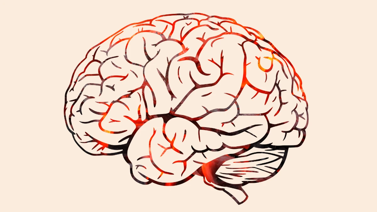 Smoldering MS – ist die „echte MS“ eine schwelende Erkrankung? | MS ...